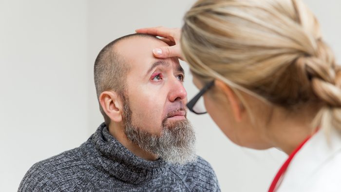 Upala oka: kako je liječiti? – JGL Obitelj